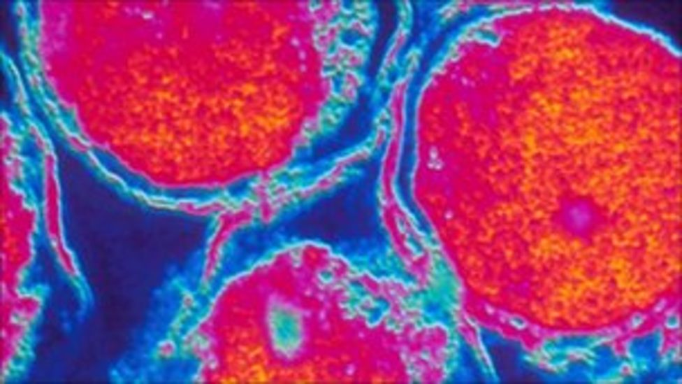 Social media promoting NHS Plymouth chalmydia testing - BBC News