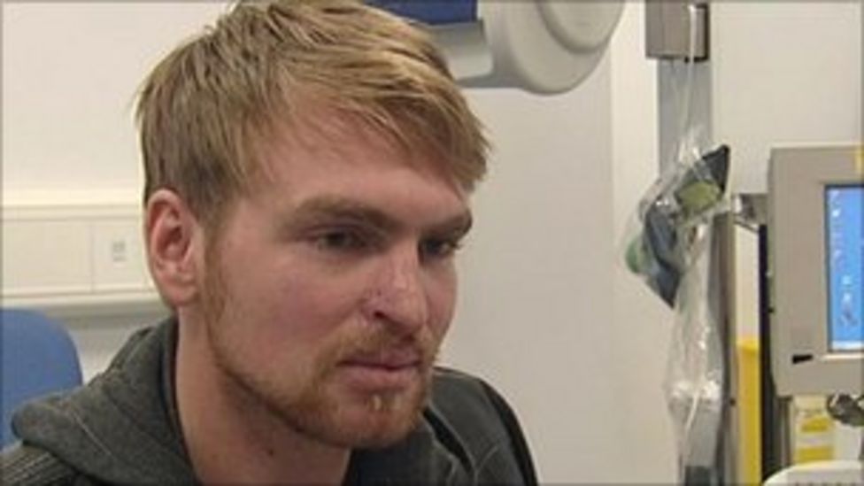 Ex-soldier burned in tank attack to run 52 marathons - BBC News