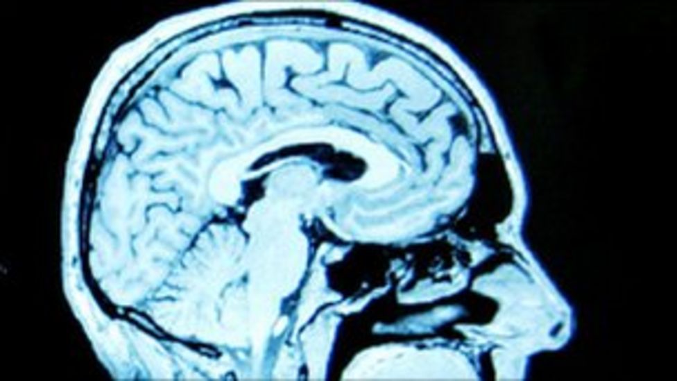 Community care after brain injury in Wales 'patchy' - BBC News