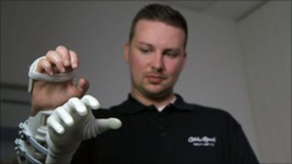 Bionic hand for 'elective amputation' patient - BBC News