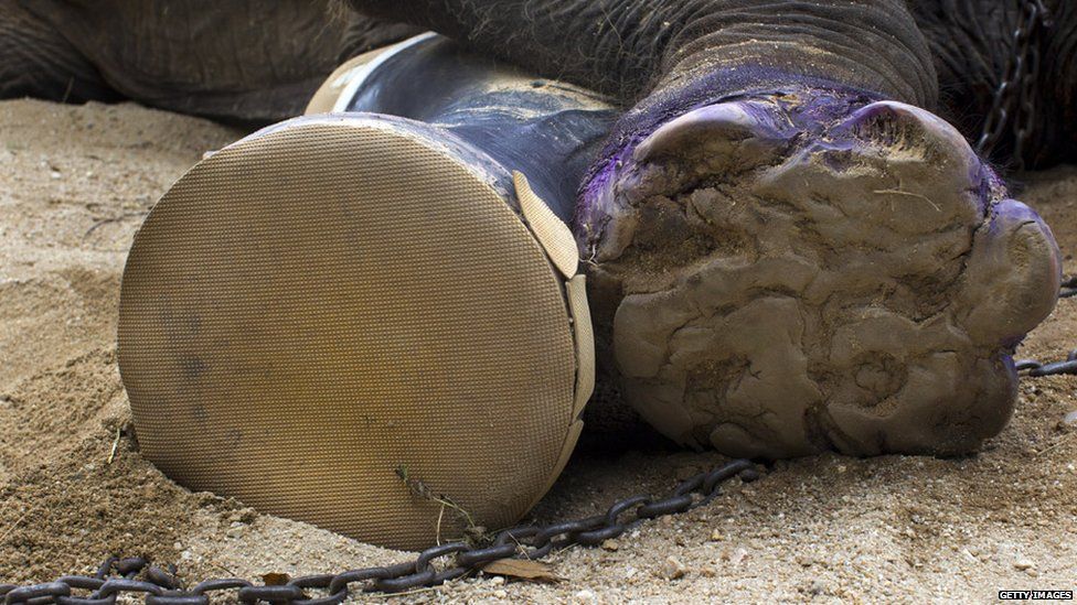 50-year-old elephant gets a new leg - BBC Newsround