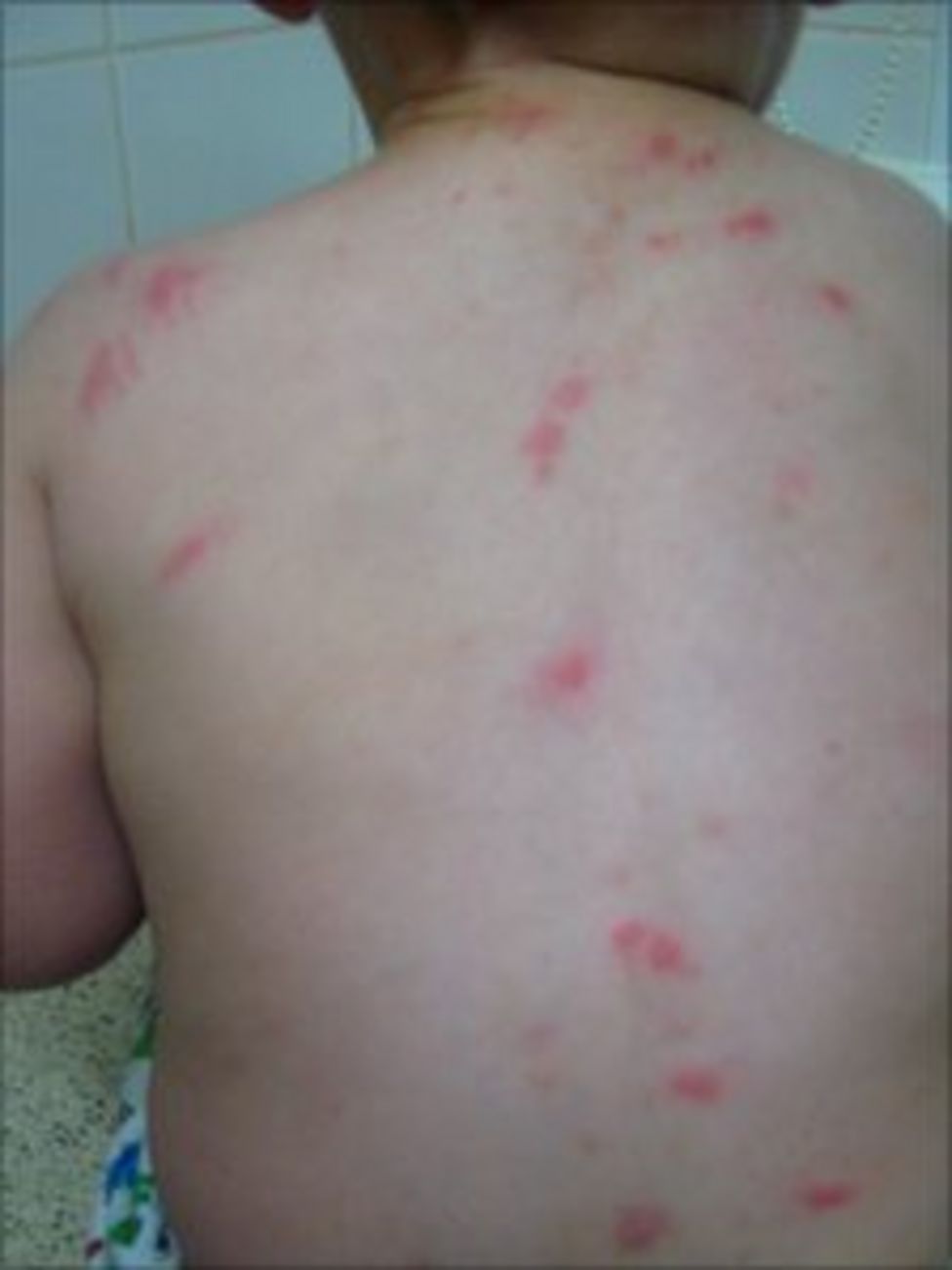 Army wife claims Bulford home 'infested with fleas' - BBC News