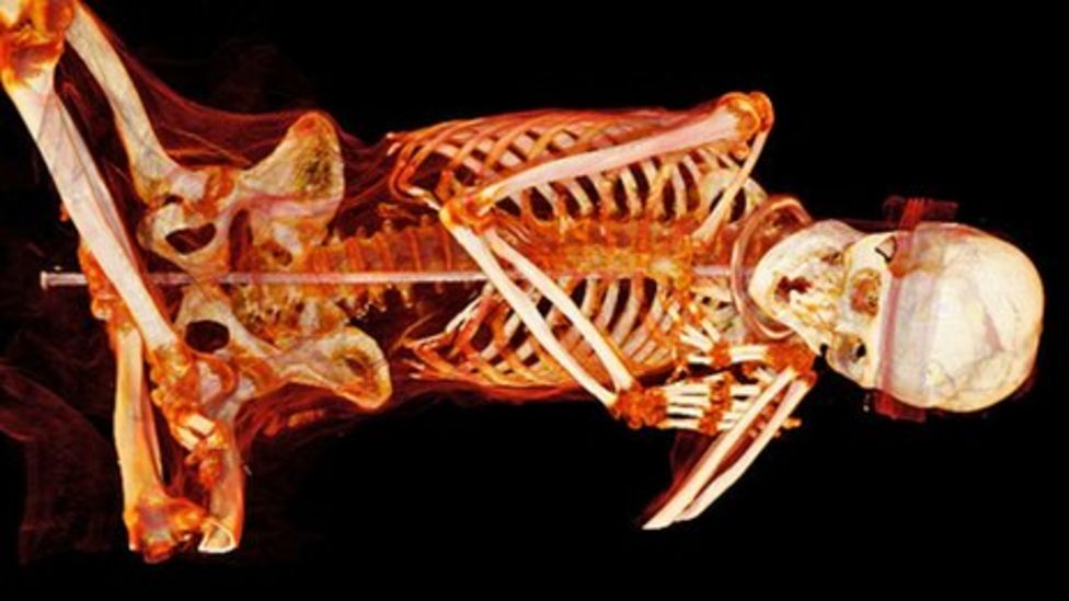 Scans bring new insights into lives of Egyptian mummies - BBC News
