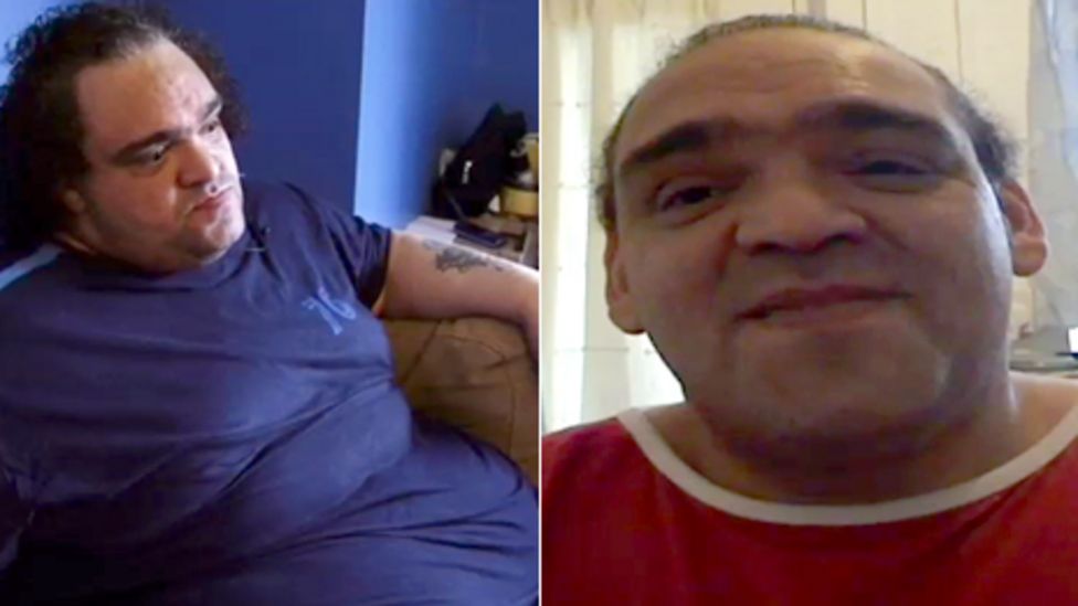 Former 50-stone man frustrated at NHS surgery rules - BBC News