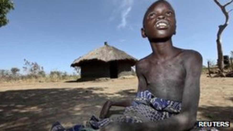 Nodding disease: First Ugandan treatment centres open - BBC News