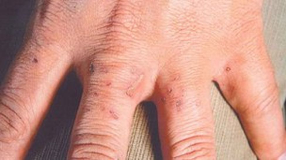 Suzanne Pilley murder trial: David Gilroy found guilty - BBC News