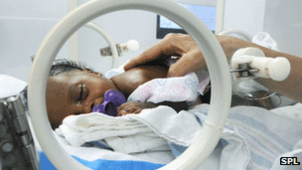 Cheap device 'reduces premature births' - BBC News