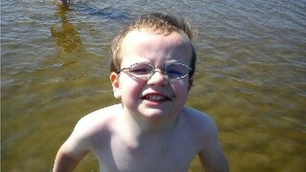 Shingles patients in West of England needed for new treatment trial ...