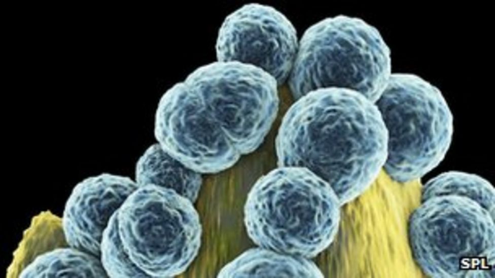 MRSA and C. diff deaths fall again - BBC News