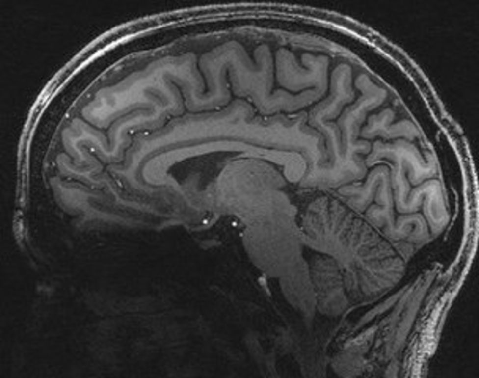 A golden age of discovery in neuroscience - BBC News