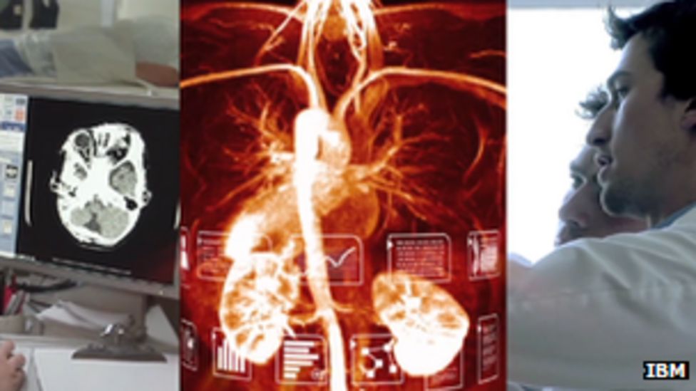 IBM's Watson supercomputer goes to medical school - BBC News