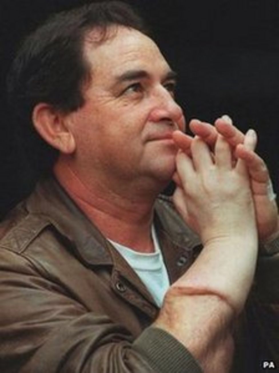 UK's first hand transplant operation - BBC News