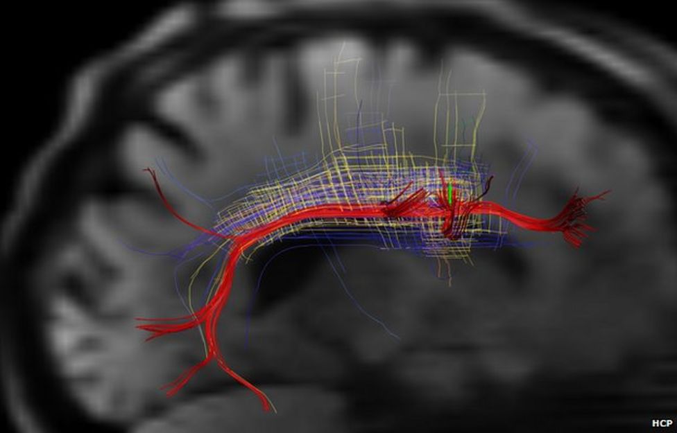 Scans reveal intricate brain wiring - BBC News