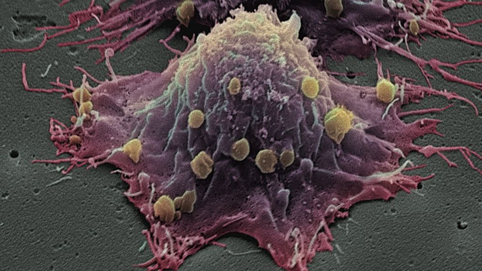 Scientists 'find cancer's Achilles heel' - BBC News