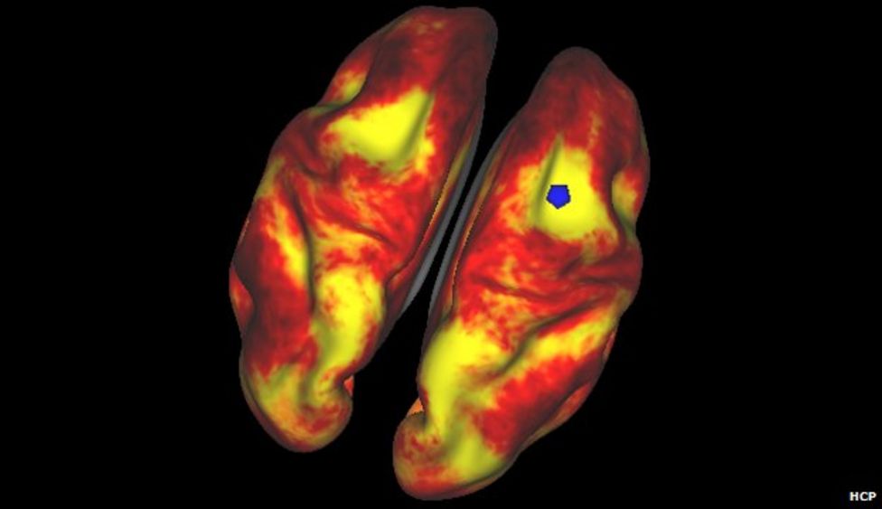 World's most detailed scans will reveal how brain works - BBC News