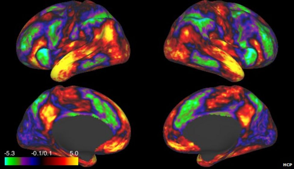 World's most detailed scans will reveal how brain works - BBC News