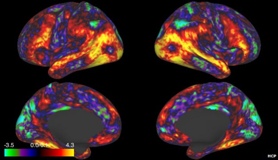 World's most detailed scans will reveal how brain works - BBC News