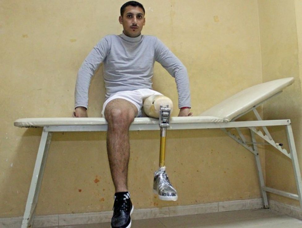 In pictures: Syria's injured refugees - BBC News
