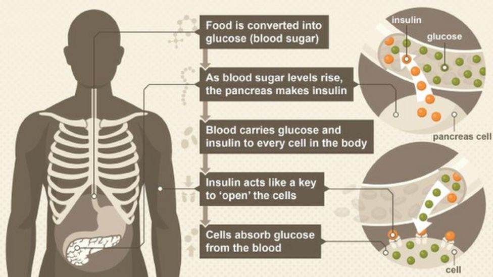 Diabetes: Pocket-sized device to allow control over insulin intake ...