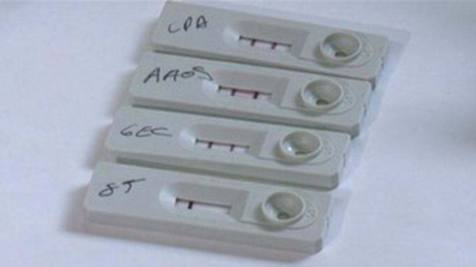 Rapid diagnostic test promises end to leprosy torment - BBC News