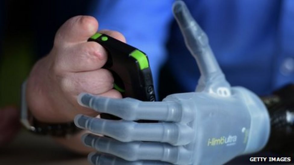 London teenager gets mobile app-controlled 'bionic arm' - BBC News