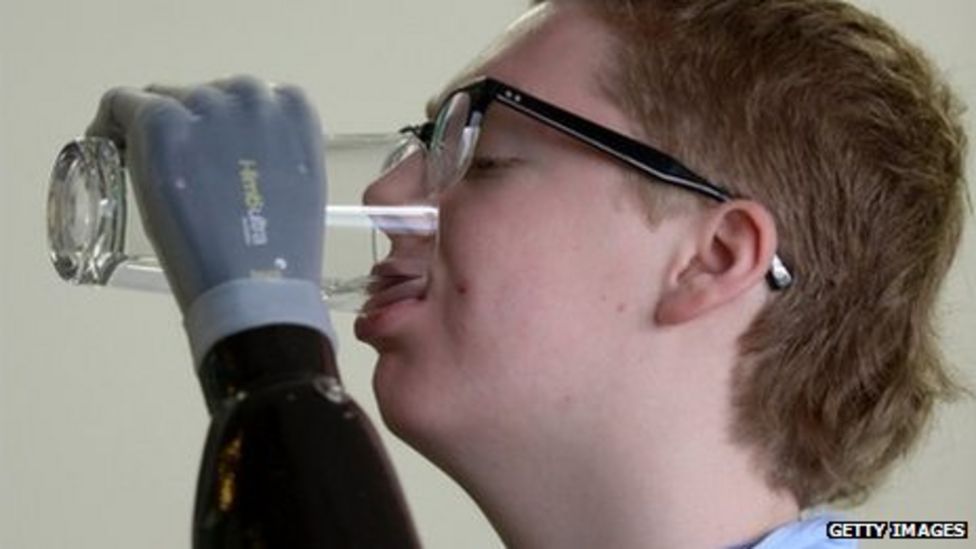 London teenager gets mobile app-controlled 'bionic arm' - BBC News