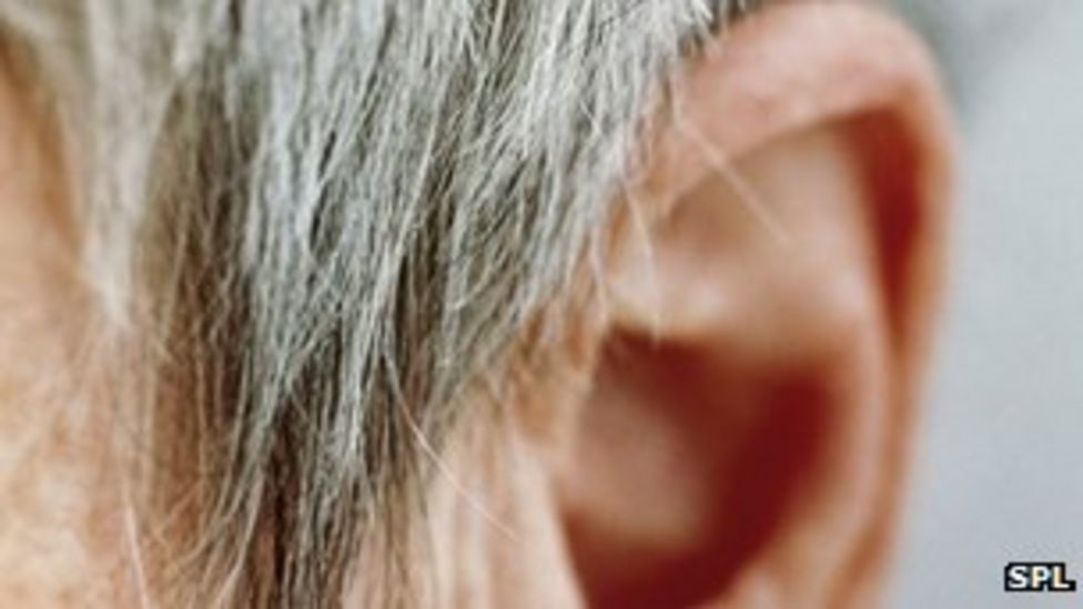 Scientists treat grey hair with drug for patchy skin - BBC News