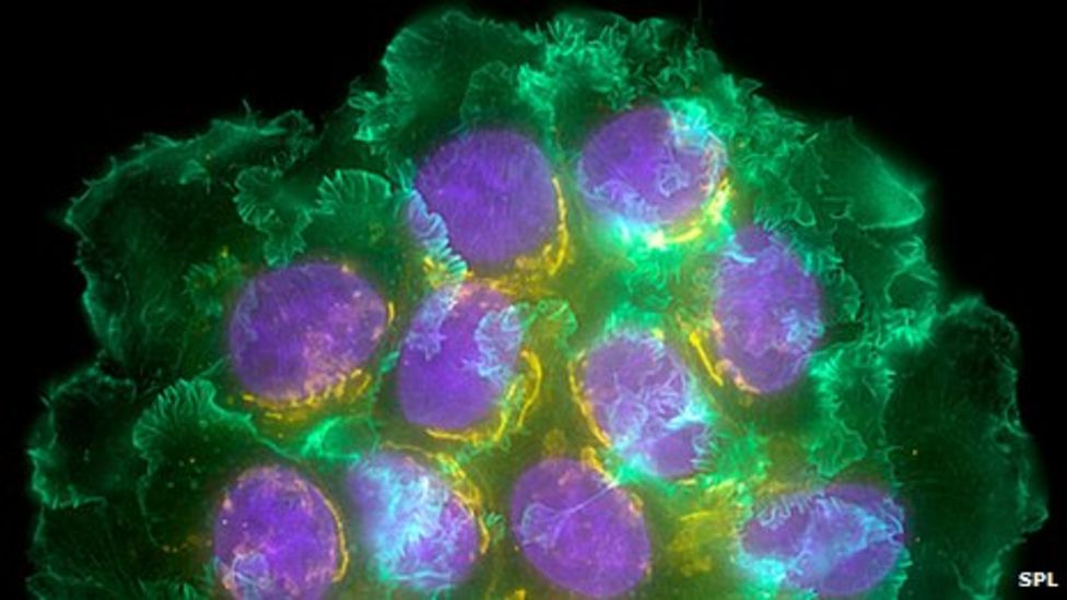 Cancer cell enzymes shown to act as 'good cops' - BBC News