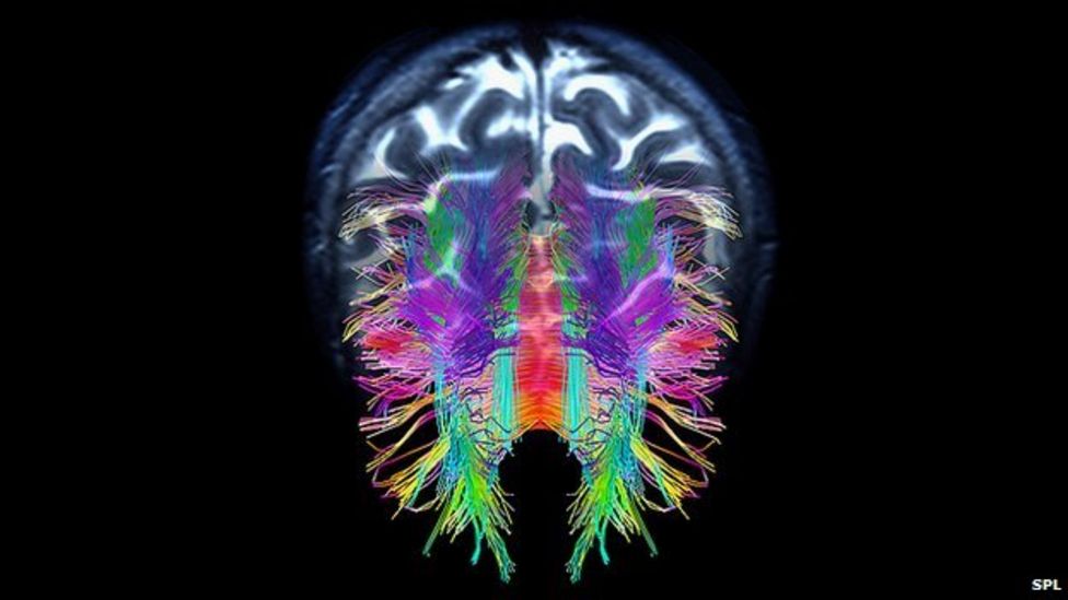 The quest to build a brain in the lab - BBC News