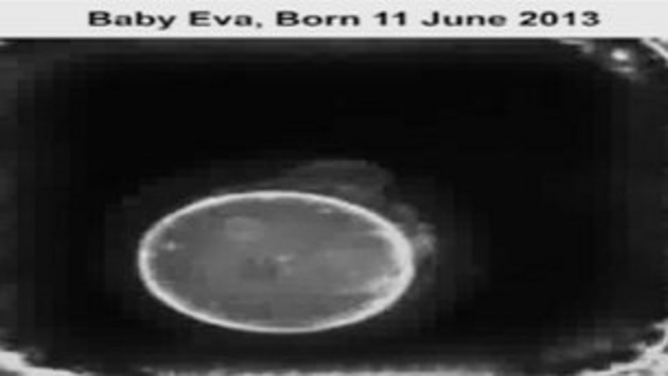 First baby conceived with time-lapse imaging IVF born in Glasgow - BBC News