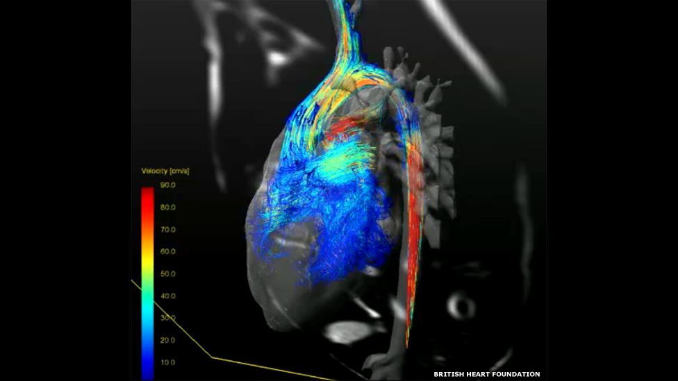 In pictures: Inside the heart - BBC News