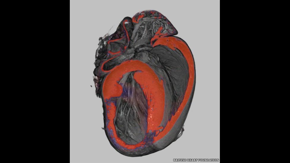 In pictures: Inside the heart - BBC News