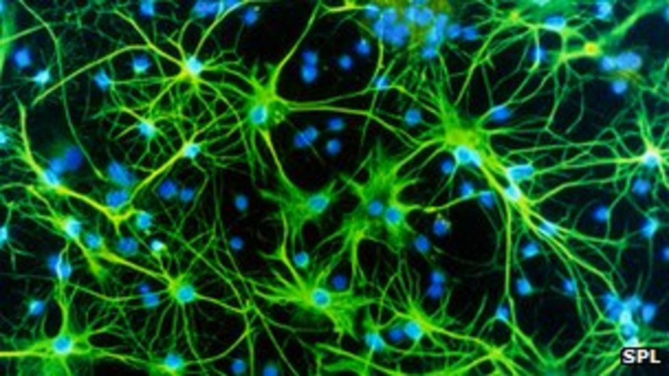 Near-death experiences are 'electrical surge in dying brain' - BBC News