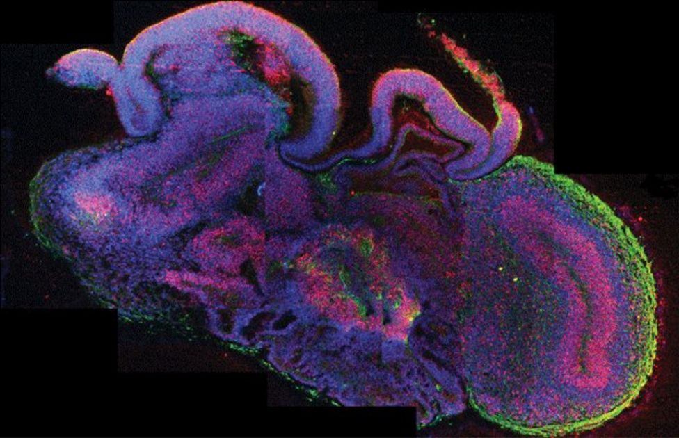 Miniature 'human brain' grown in lab - BBC News