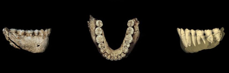 'Ancient humans' used toothpicks - BBC News