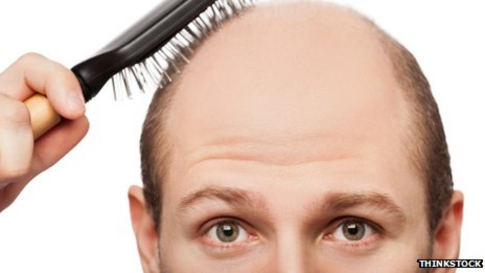 Baldness Treatment A Step Closer Bbc News