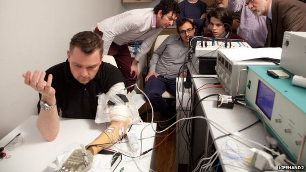 Bionic hand allows patient to 'feel' - BBC News