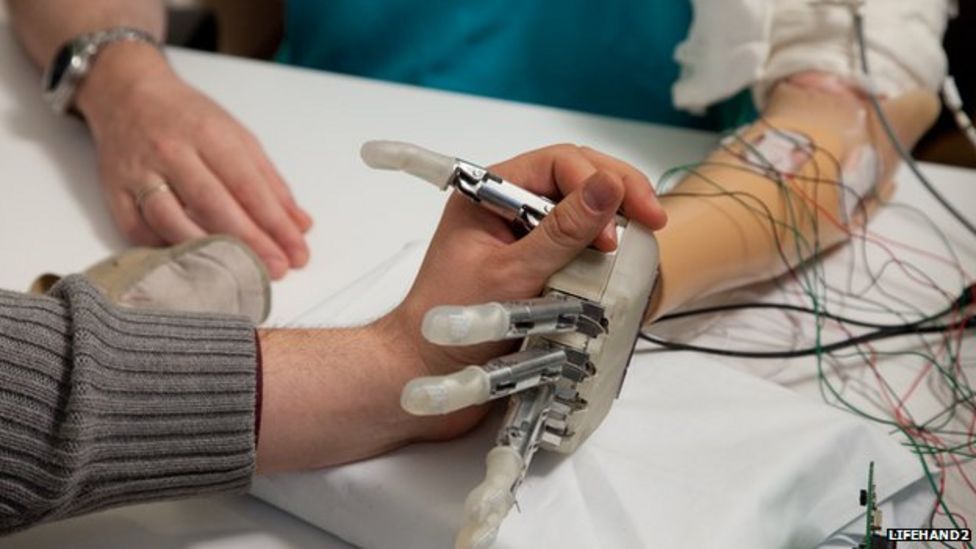 Bionic hand allows patient to 'feel' - BBC News