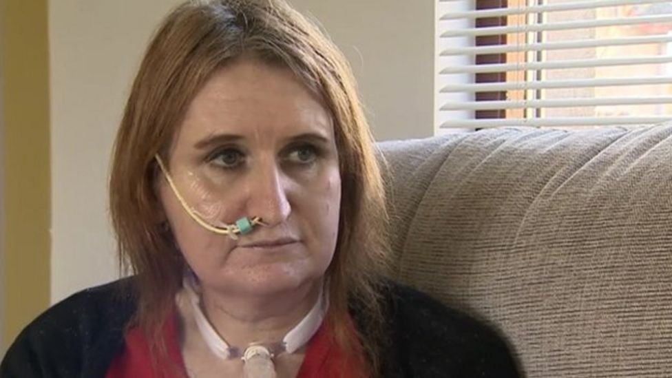 Stag gore victim Kate Stone able to eat after four months - BBC News