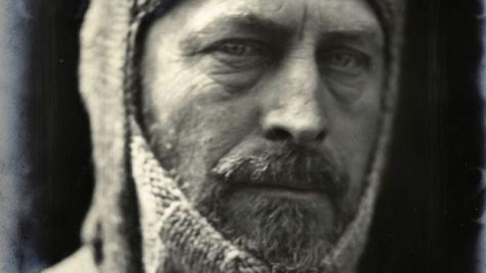 The man who cut out his own appendix - BBC News