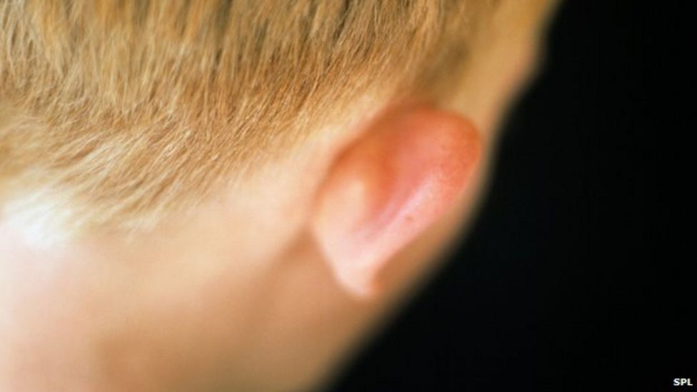 Great Ormond Street doctors aim to grow ears from fat - BBC News