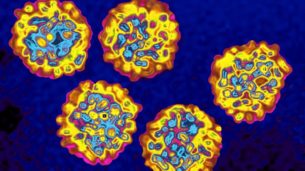 Viral hepatitis 'kills as many as Aids or TB' - BBC News