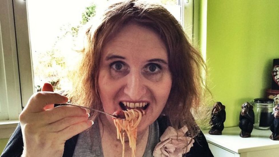 Stag gore victim Kate Stone able to eat after four months - BBC News