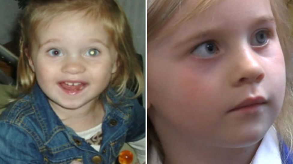 Facebook photo revealed two-year-old's eye cancer - BBC News