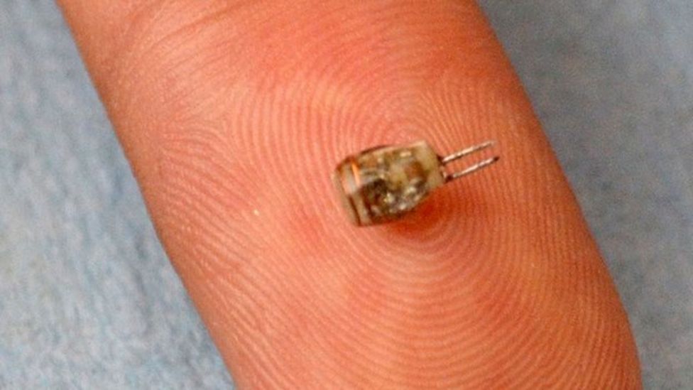 Middlesbrough doctors fit woman with wireless pacemaker - BBC News