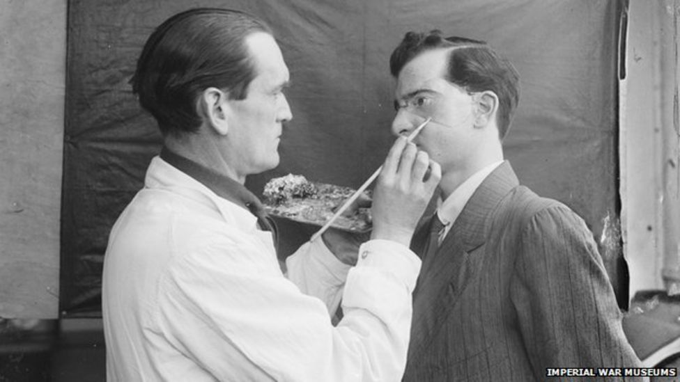 World War One: Soldiers helped at Wandsworth 'Tin Noses Shop' - BBC News