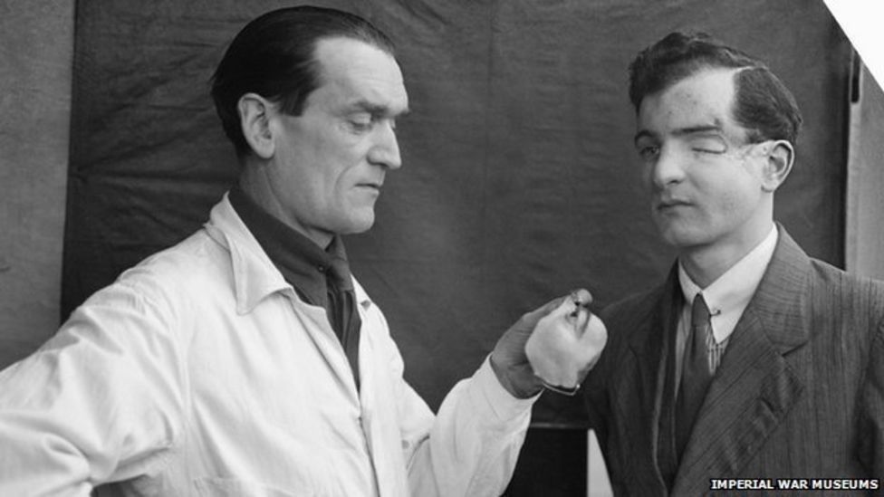 World War One: Soldiers helped at Wandsworth 'Tin Noses Shop' - BBC News