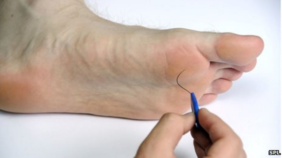 Pre-diabetes label 'worthless', researchers claim - BBC News