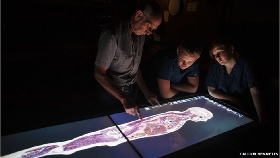 Anatomy students work on life-size virtual cadaver at University of ...