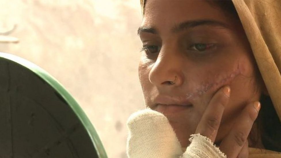 Love, honour and the Pakistani girl who lived - BBC News